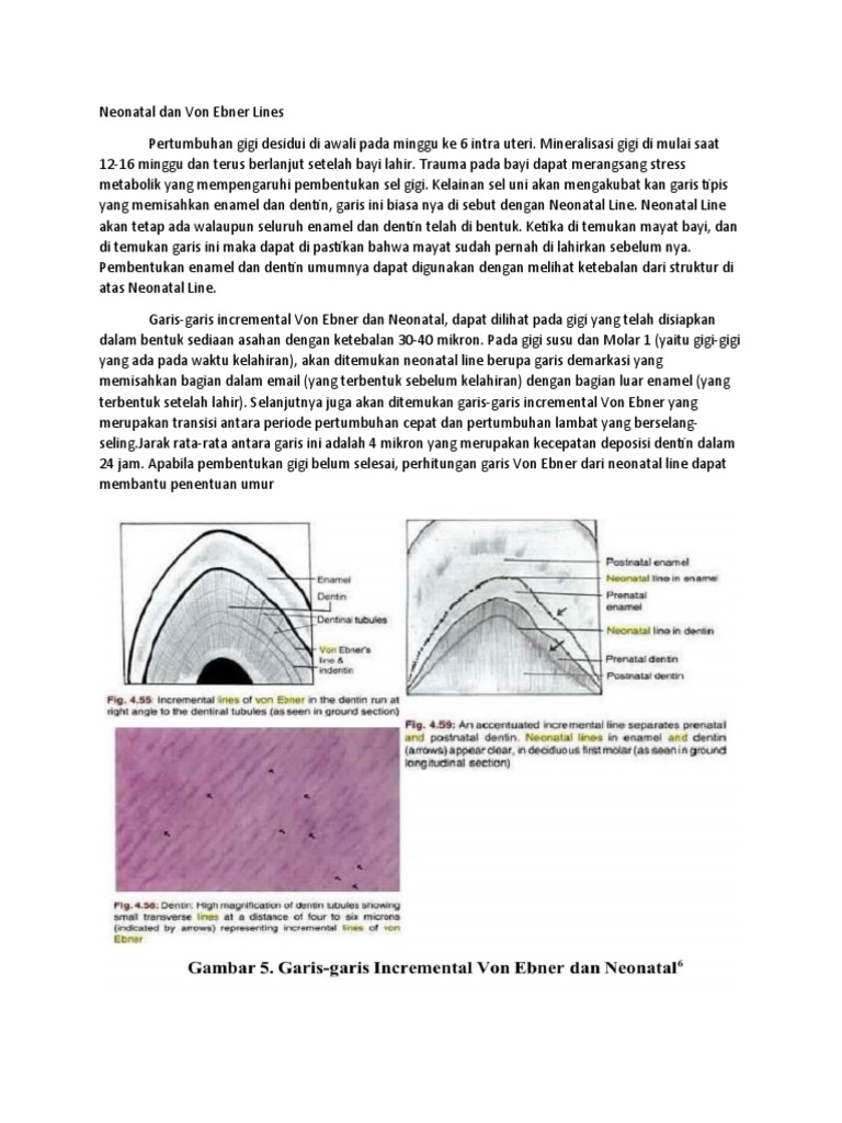 Neonatal Dan Von Ebner Lines | PDF