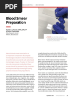 Dialyzer Reprocessing Flow Chart | PDF