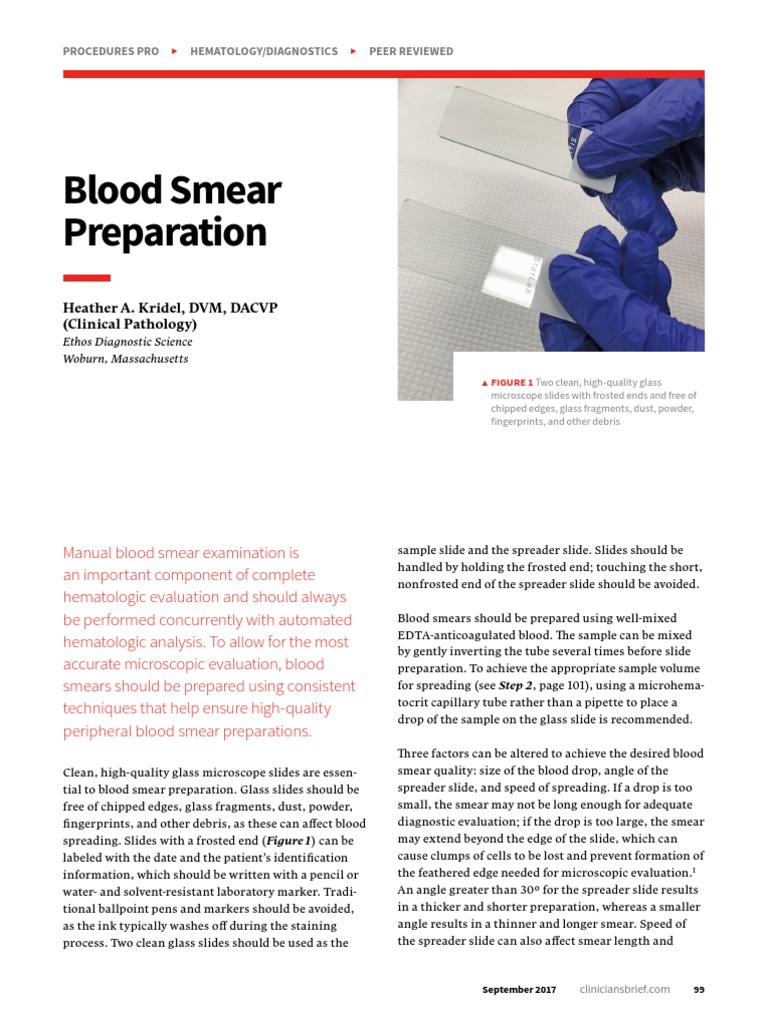 Blood Smear Preparation | PDF | Medical Specialties | Clinical Medicine