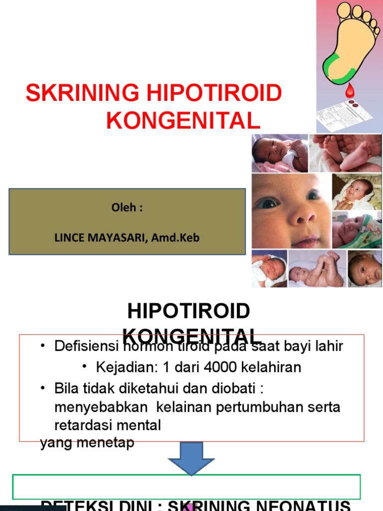 Skrining Hipotiroid Kongenital | PDF