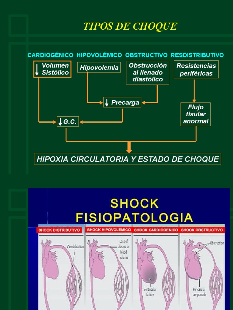 Fisiopatología Del Shock Hipovolémico