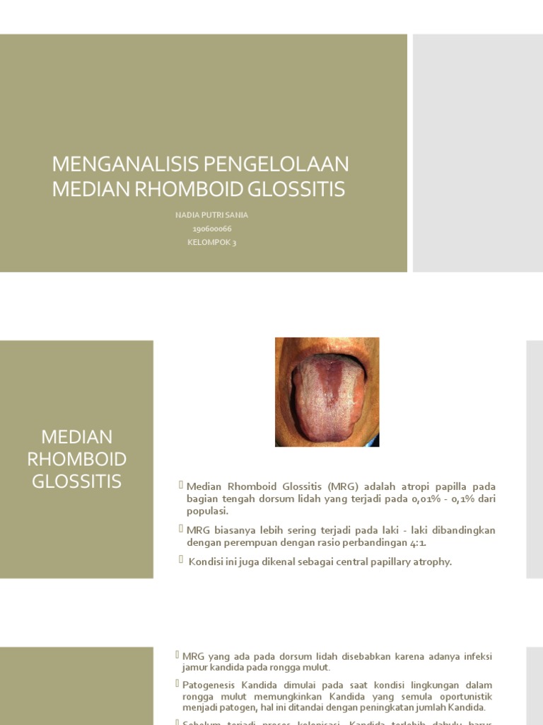 Median Rhomboid Glossitis | PDF