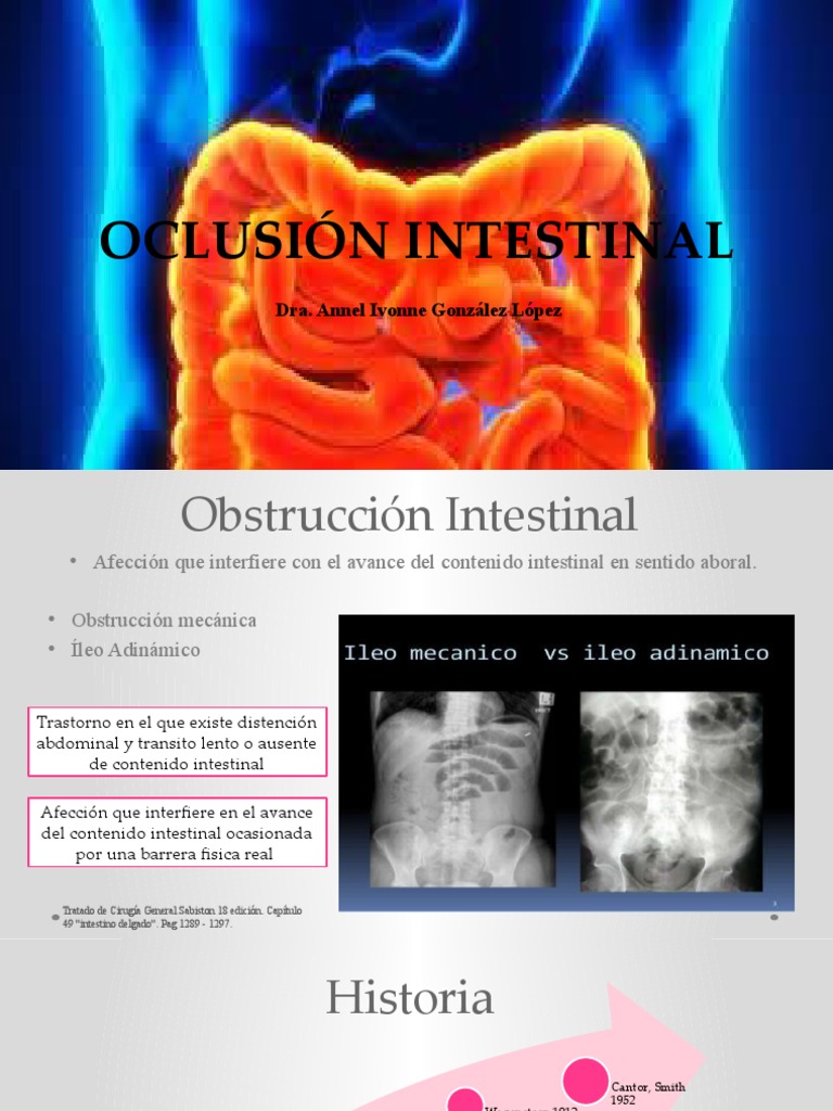 Manejo de la Obstrucción Intestinal | PDF | Enfermedad de Crohn ...