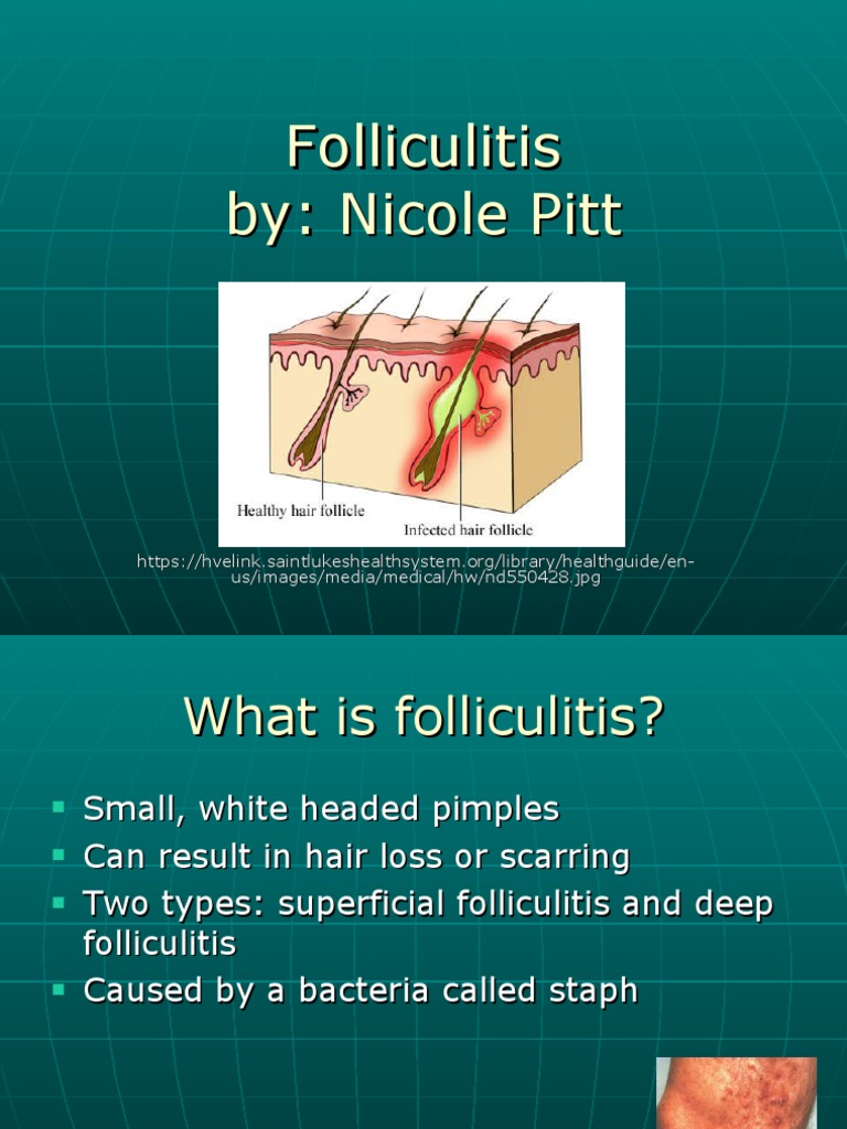 Tatalaksana Folliculitis | PDF