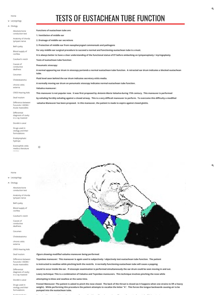 Assessment of Eustachian Tube Function: A Review of Clinical Tests and ...