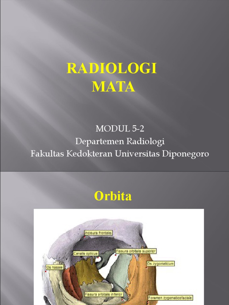 RADIOLOGI MATA Modul 5.2 | PDF | Magnetic Resonance Imaging | Ct Scan