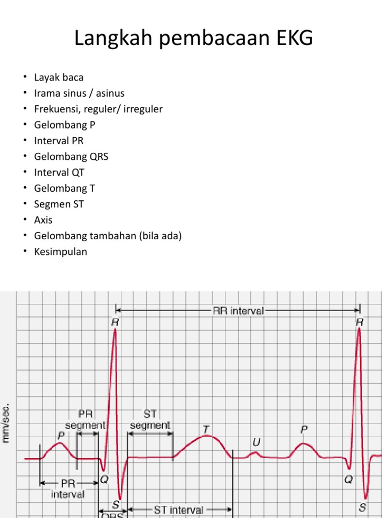 Cara Membaca Ekg | PDF | Ilmu Sosial | Seni