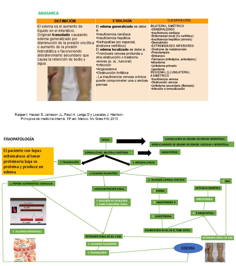 ANASARCA | PDF | Edema | Rtt