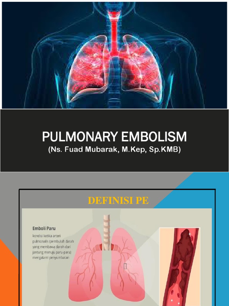 DIAGNOSIS DAN PENATALAKSANAAN EMBOLI PARU | PDF