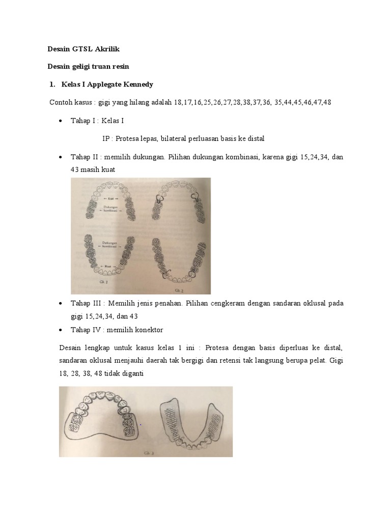 Desain GTSL Akrilik | PDF