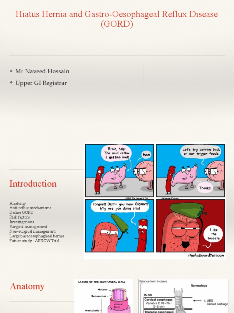 Reflux and Hiatus Hernia 1 | PDF | Gastroesophageal Reflux Disease ...