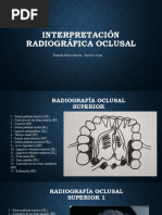 Canino Temporal Superior | PDF | Anatomia dental | Diente