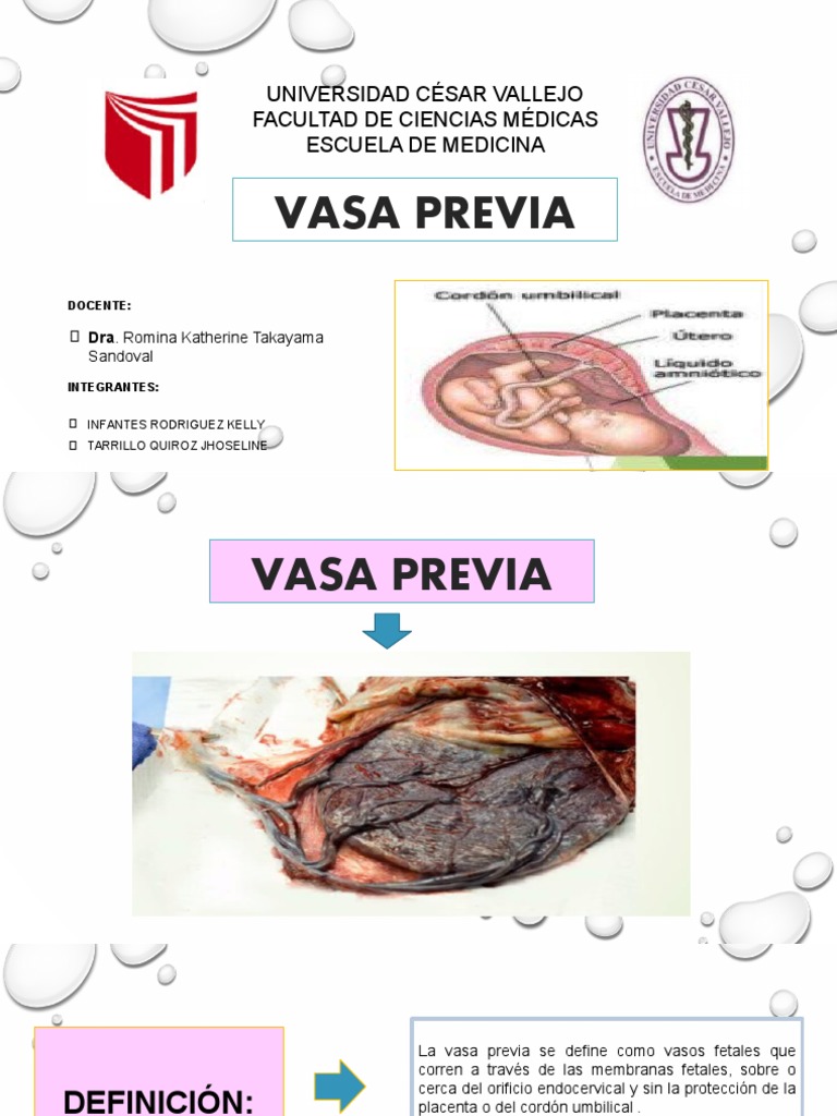 Vasa Previa Iii Unidad | PDF | Placenta | Parto