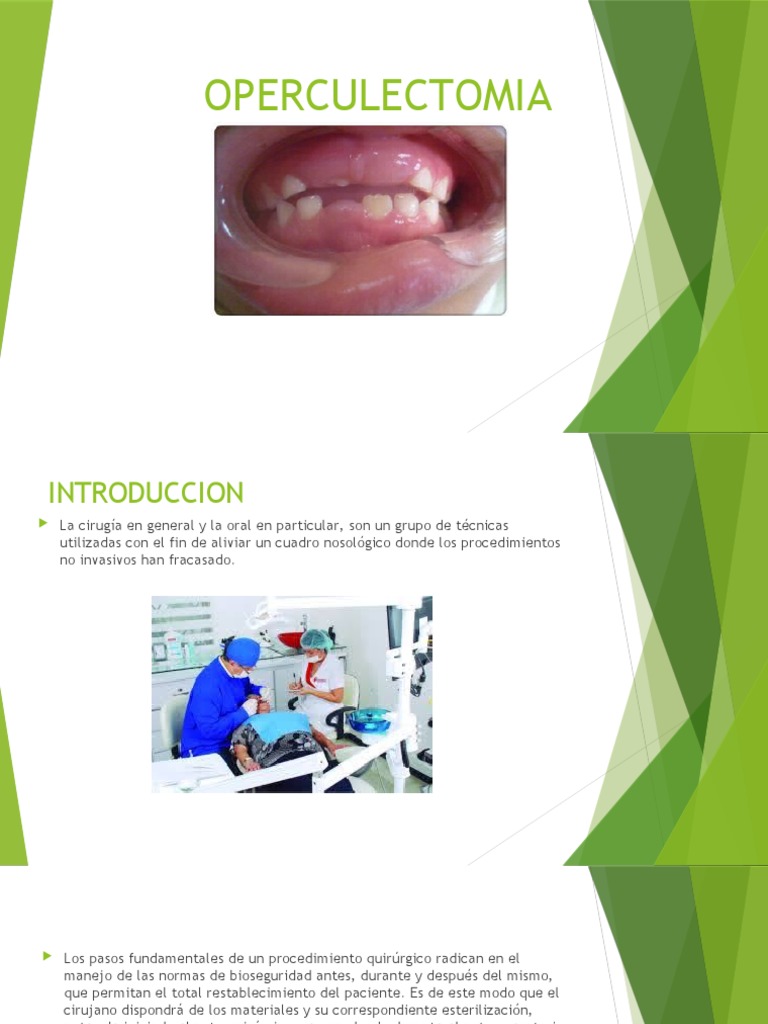 Operculectomía: Procedimiento y Técnicas | PDF | Cirugía | Cuidado de ...