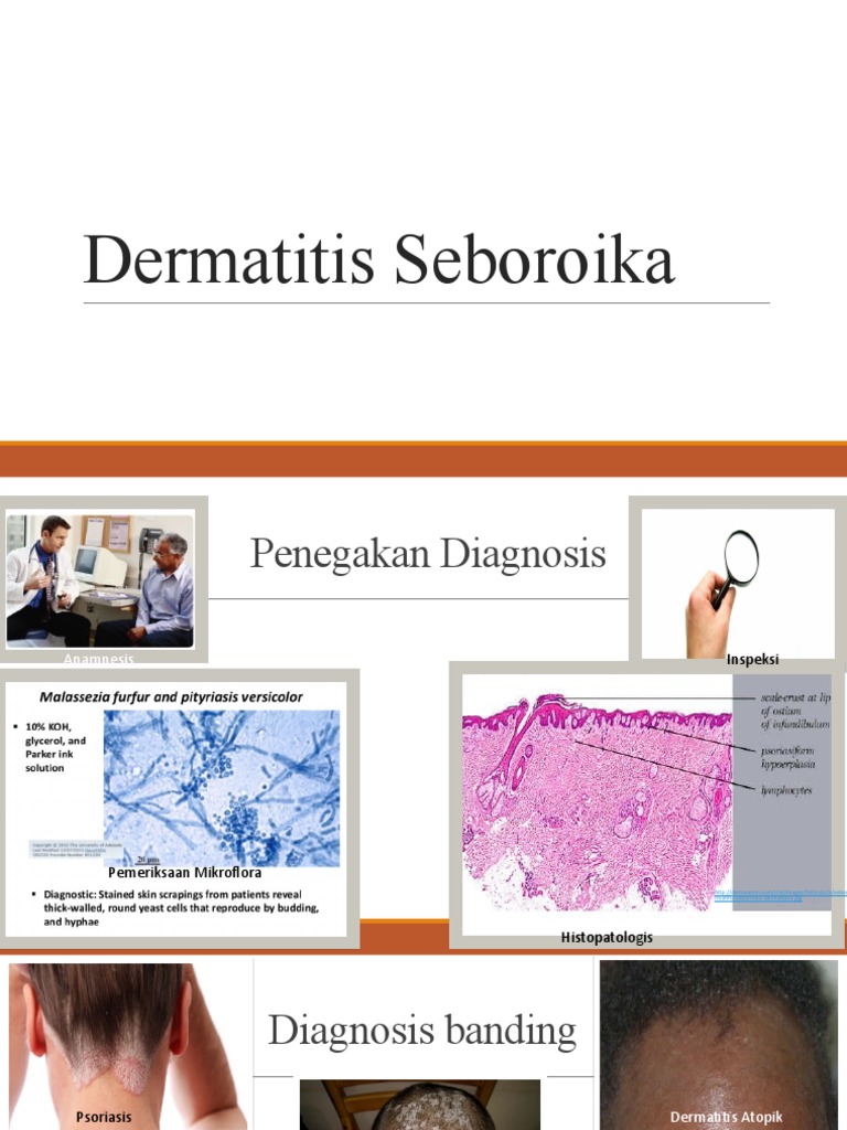 Dermatitis Seboroik YAUL | PDF