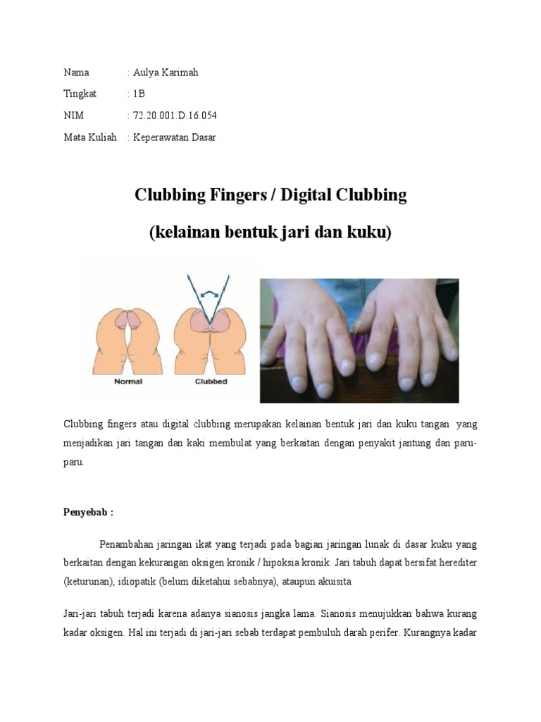 Keperawatan Dasar (Clubbing Finger) | PDF