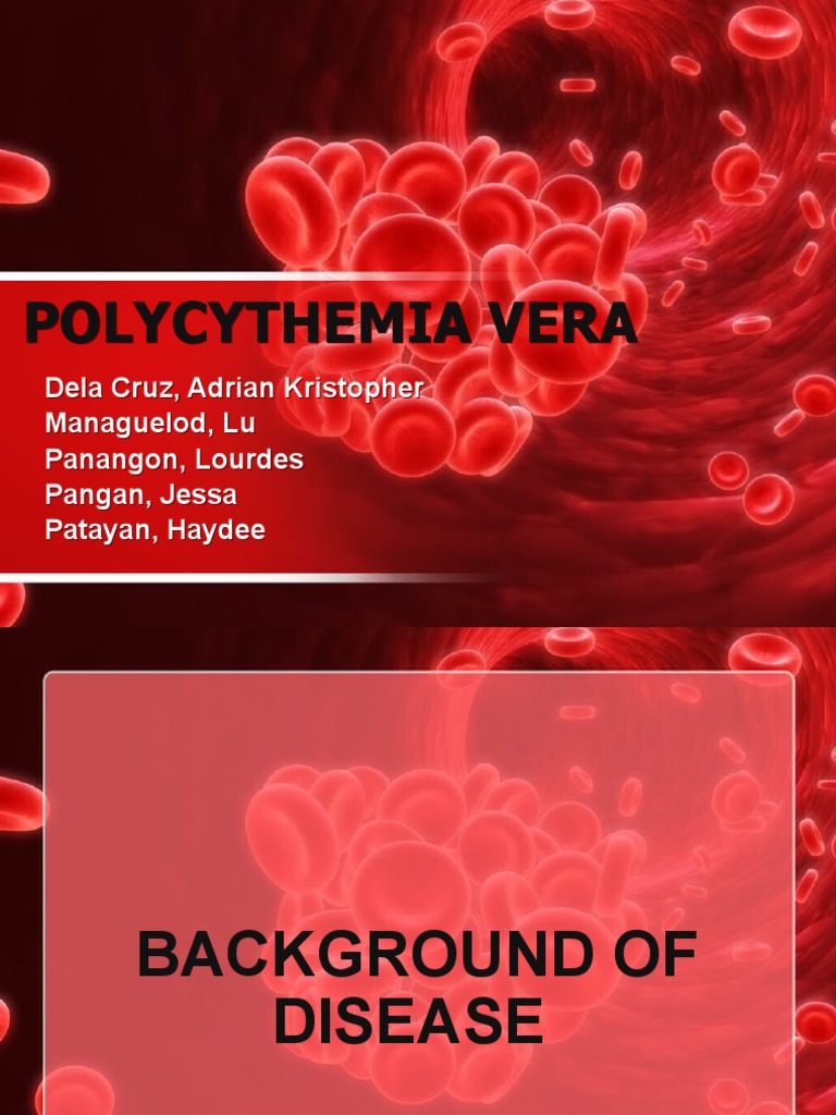 Polycythemia-Vera-Report | Anatomy | Tissue (Biology)