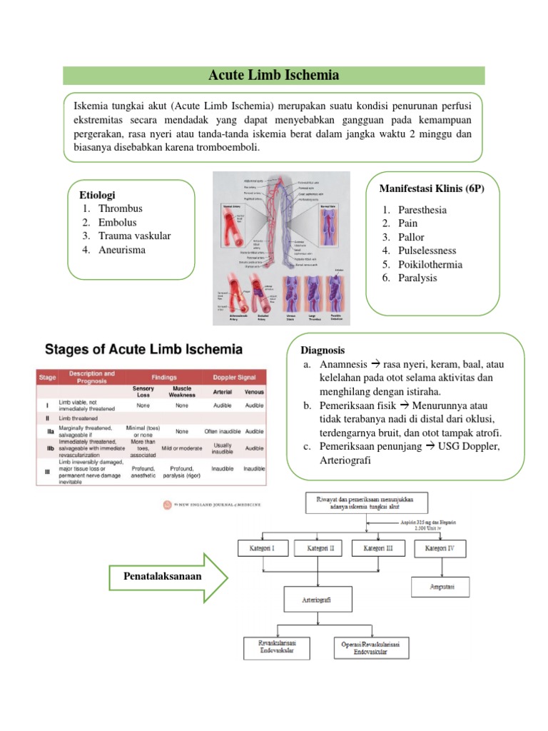 Acute Limb Ischemia | PDF
