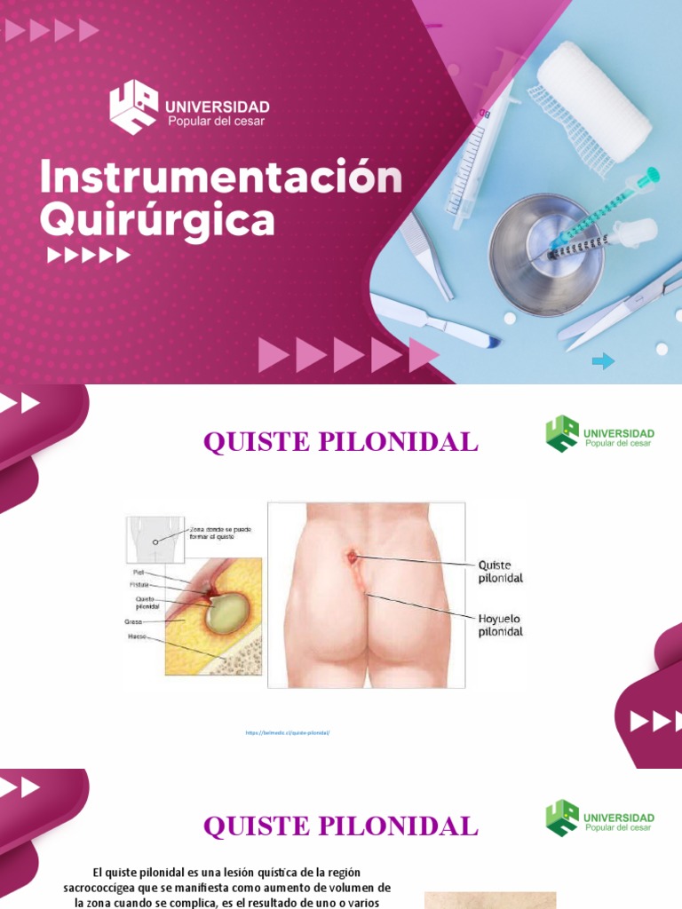 Unidad 3. Quiste Pilonidal | PDF | Medicina CLINICA | Anatomía