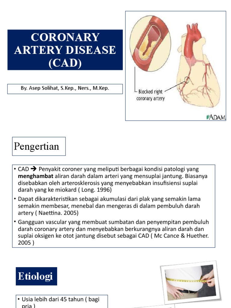 Coronary Artery Disease (CAD) | PDF | Sains & Matematika