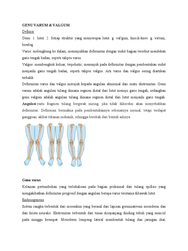 Genu Varum dan Valgum: Definisi dan Etiologi | PDF | Sains & Matematika