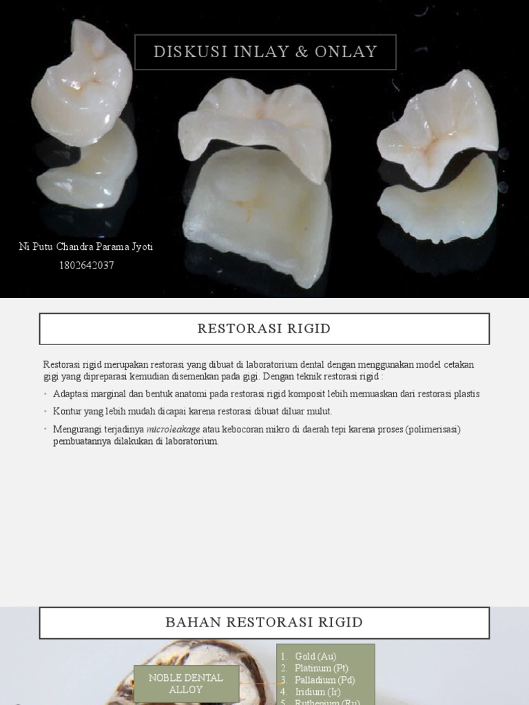 Inlay Onlay | PDF | Teknologi & Rekayasa
