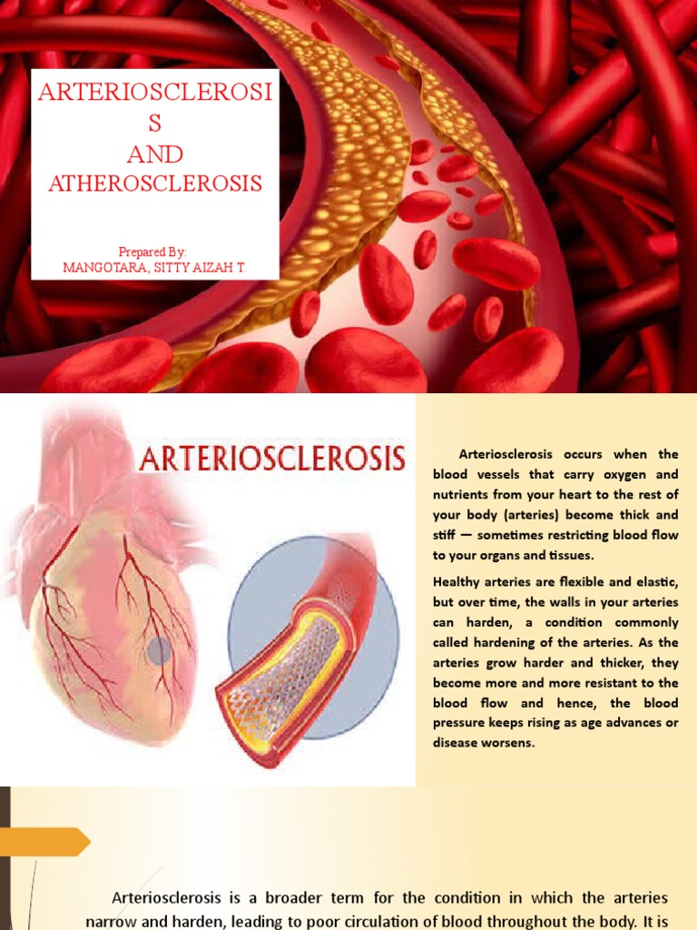 Arteriosclerosis & Atherosclerosis | PDF | Atherosclerosis | Artery