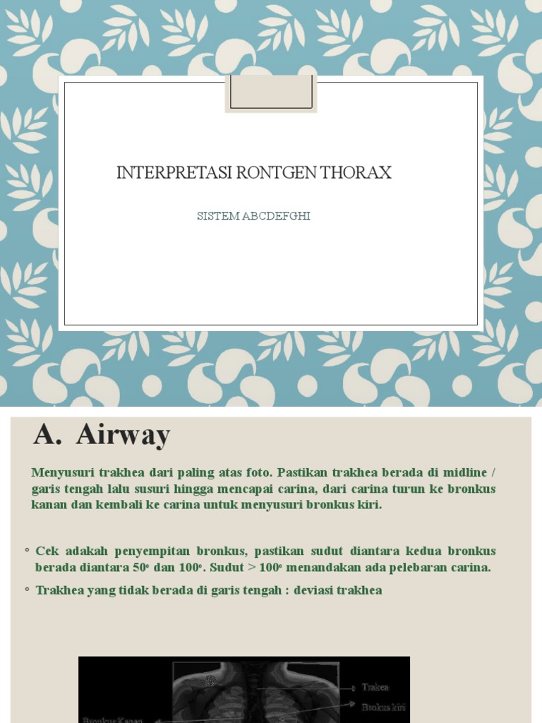 Interpretasi Rontgen Thorax | PDF