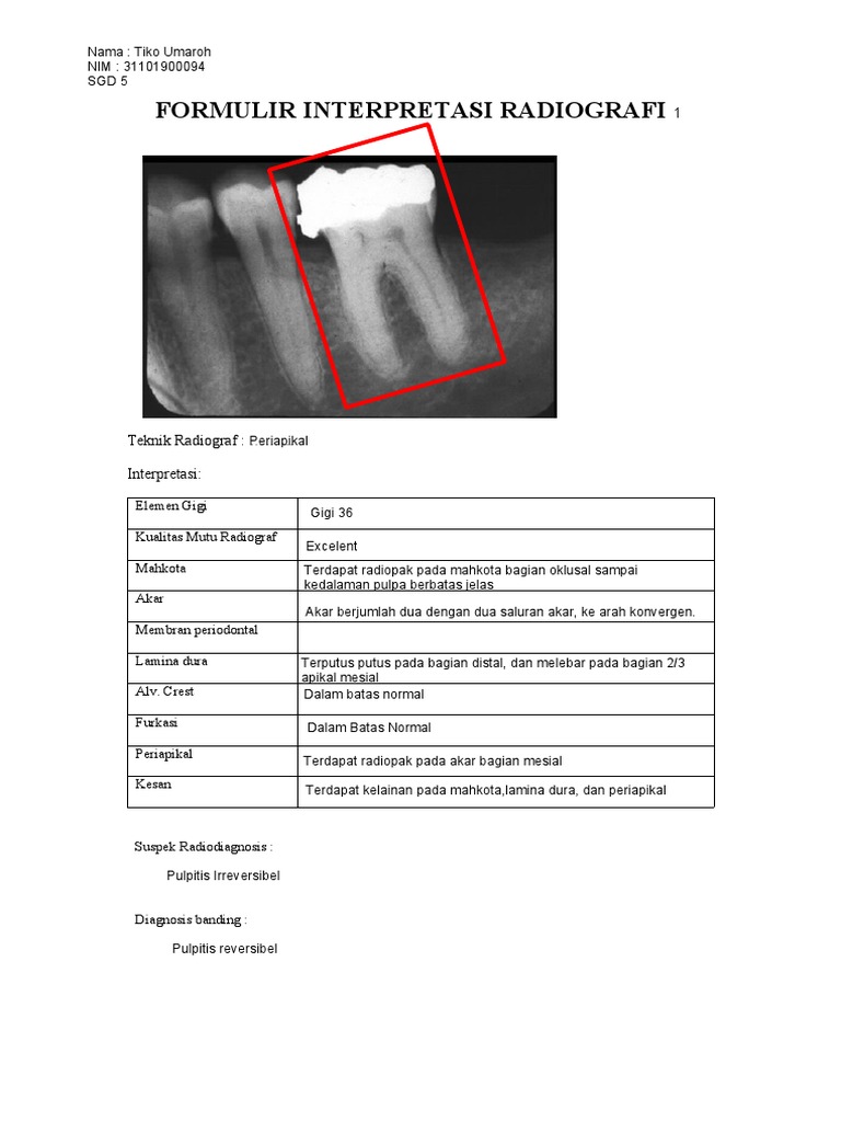 SL - Radiogradi Tumpatan | PDF