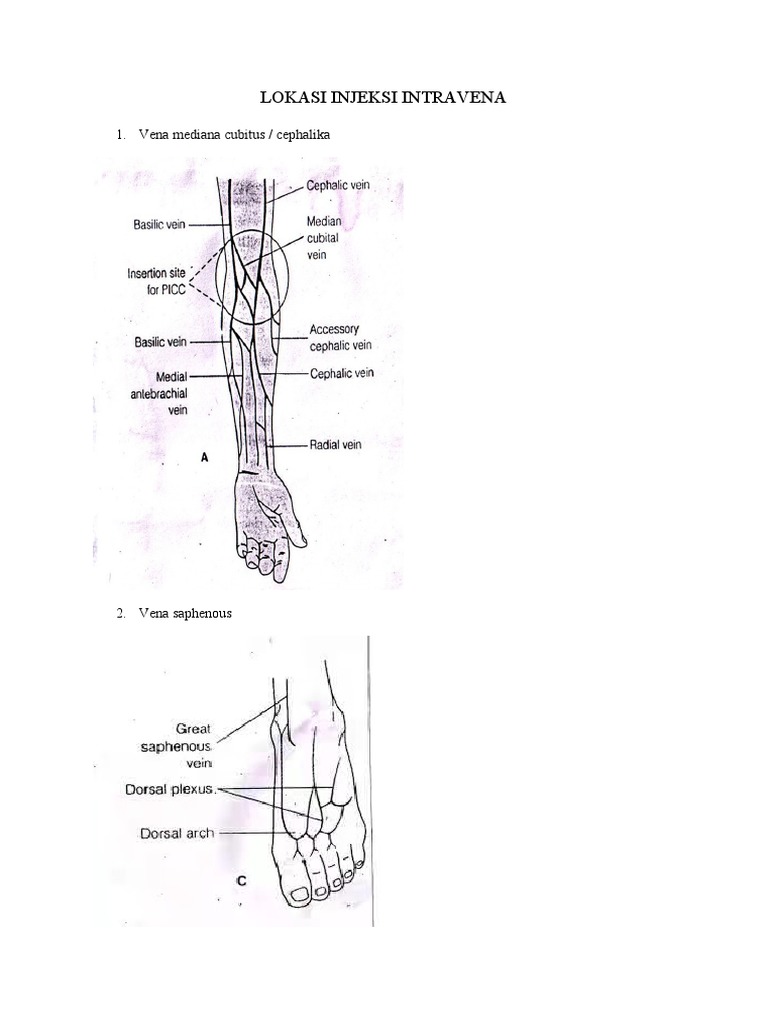 Lokasi Injeksi Intravena
