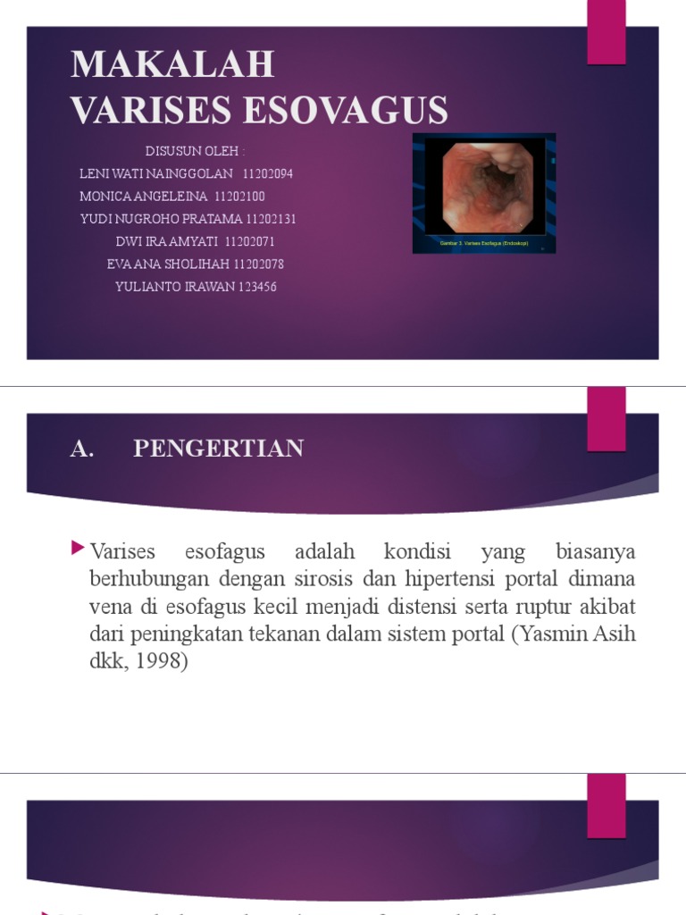 Tatalaksana Varises Esofagus dan Komplikasinya | PDF | Kajian Bahasa ...