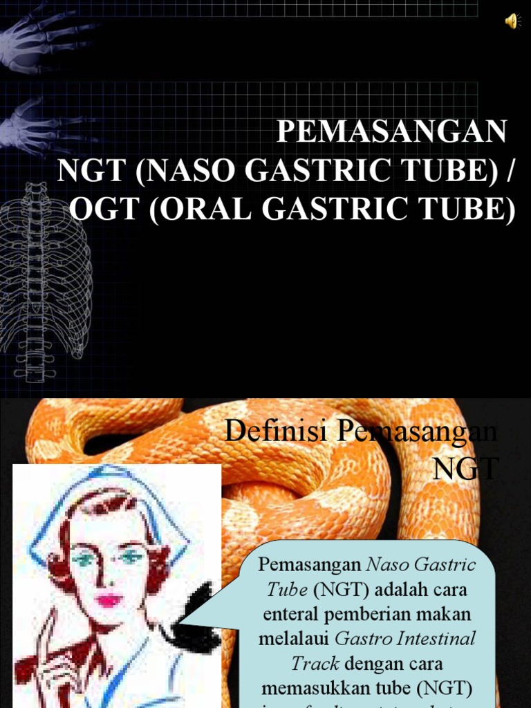 Pemasangan NGT | PDF