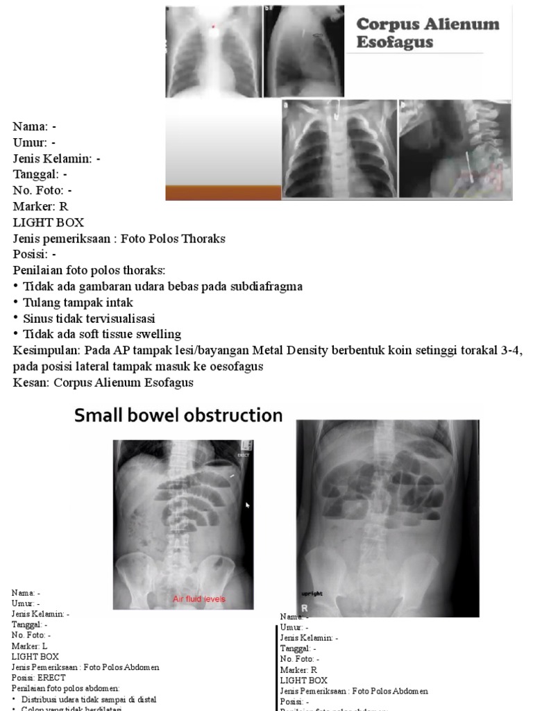 CSL Radiologi GEH NEW | PDF