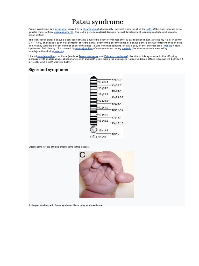 Patau Syndrome: Signs and Symptoms | PDF | Human Diseases And Disorders ...