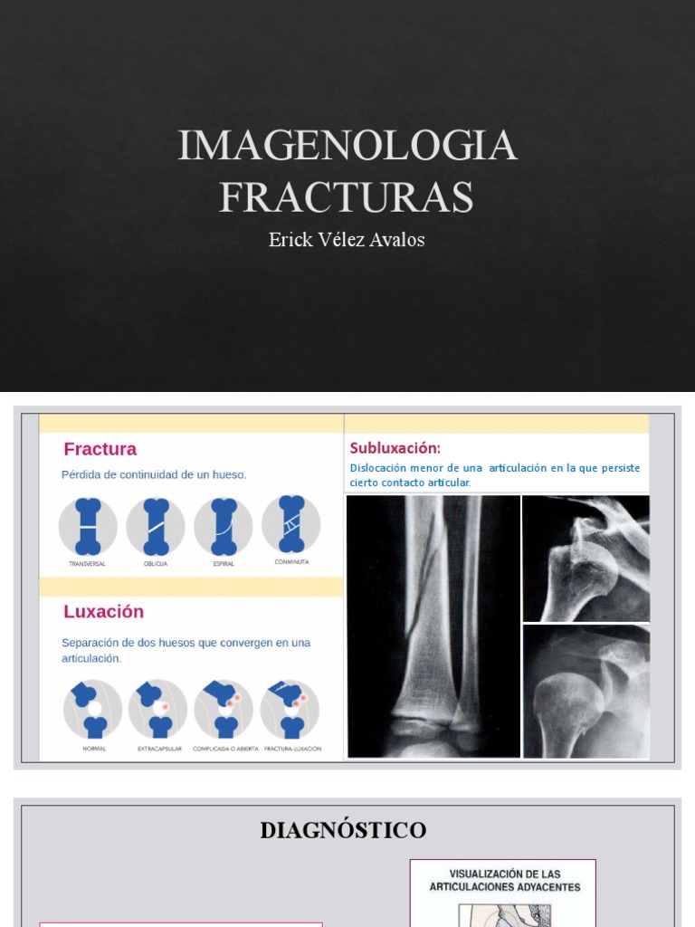 Imagenologia Fracturas | PDF | Hueso | Lesión