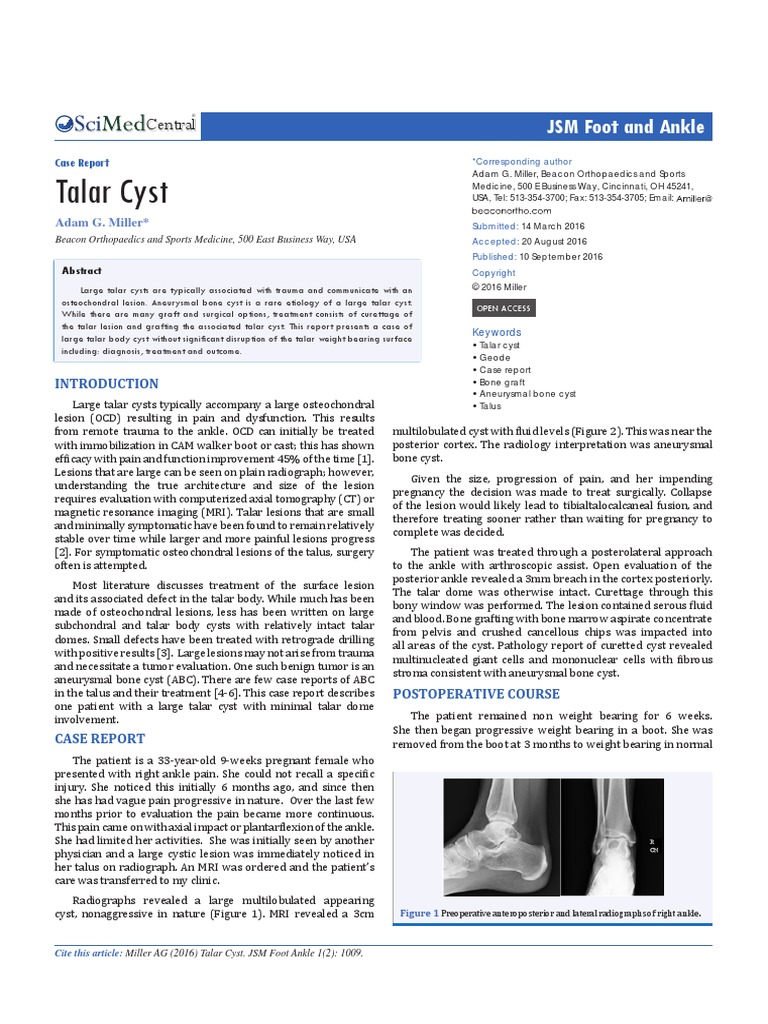 Talar Cyst: JSM Foot and Ankle | PDF | Ankle | Clinical Medicine