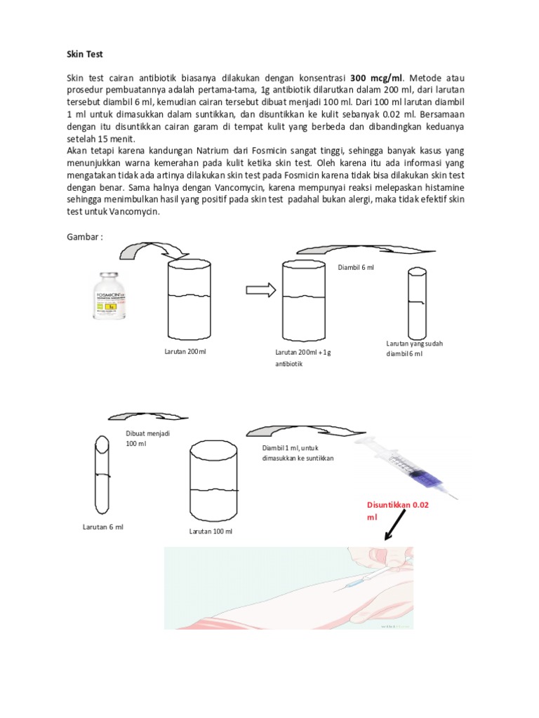 Prosedur Skin Test Antibiotik | PDF