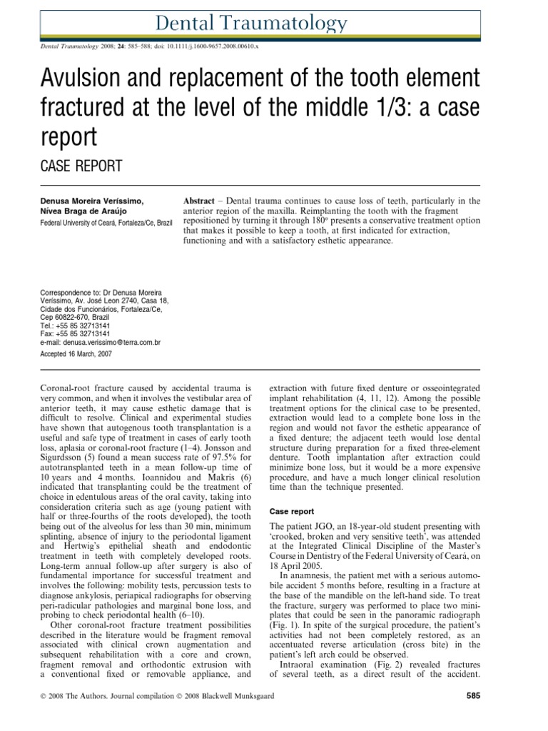 Avulsion and Replacement of The Tooth Element Fractured at The Level of ...