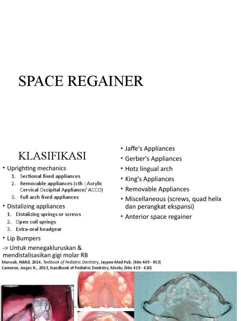 Space Regainer | PDF