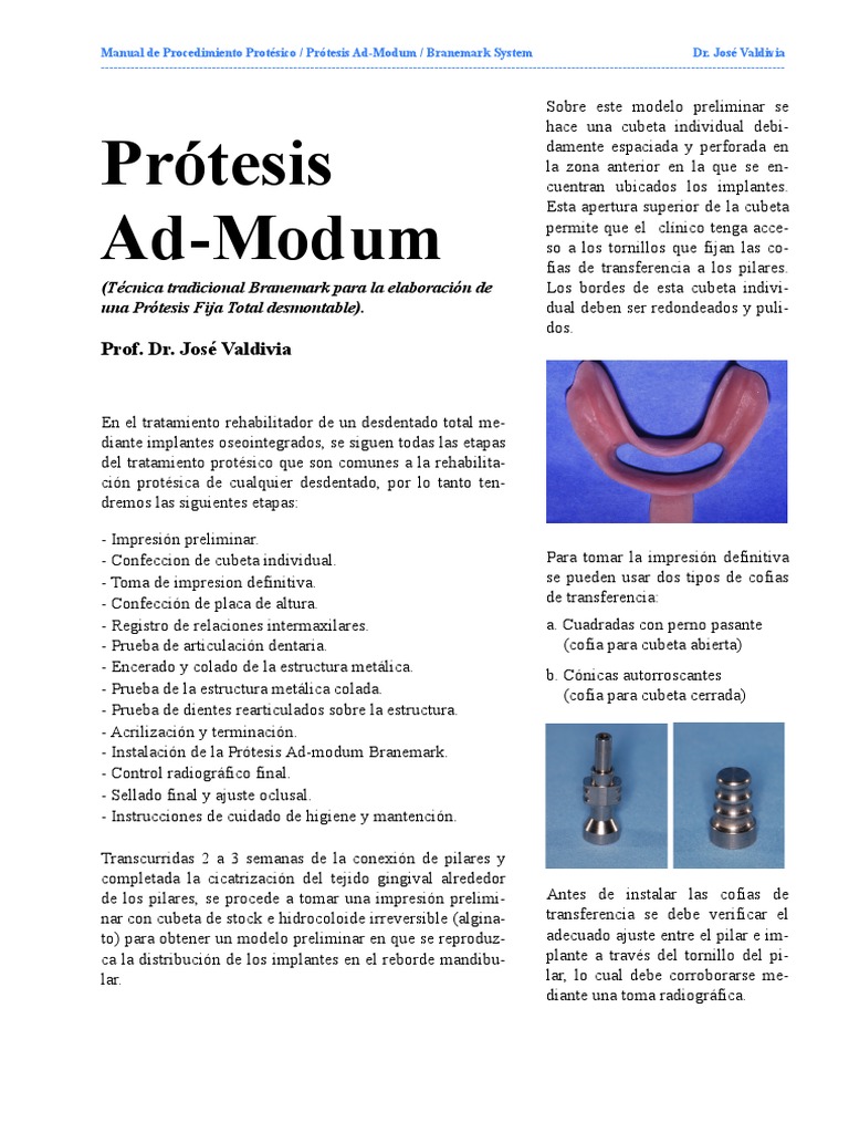Protesis Ad-Modum | Descargar gratis PDF | Dentadura postiza | Tornillo