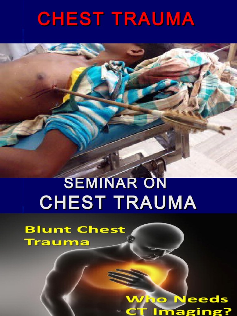 Chest Trauma Toolkit For Junior Residents | PDF | Thorax | Heart