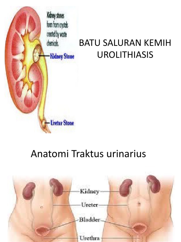 Ppt Batu Saluran Kemih Pdf 