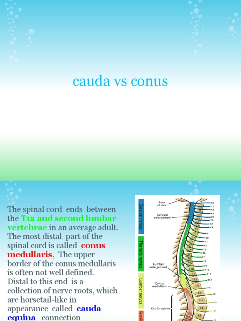 Cauda Equina Syndrome Vs Conus Medullaris