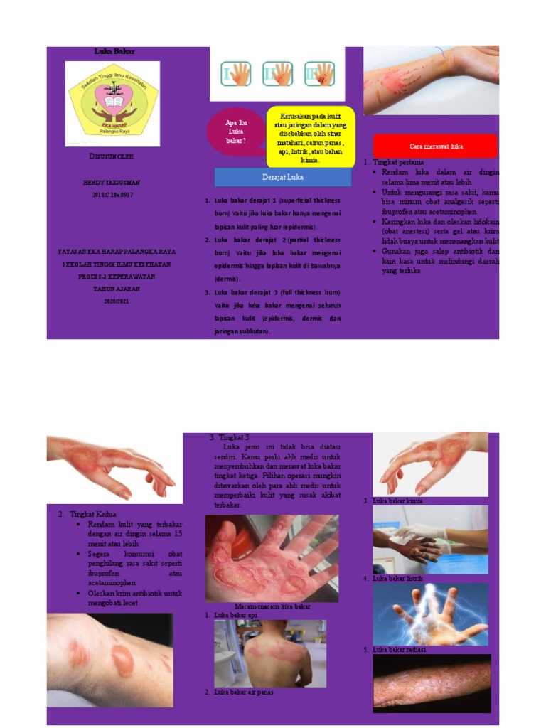 Leaflet Luka Bakar | PDF