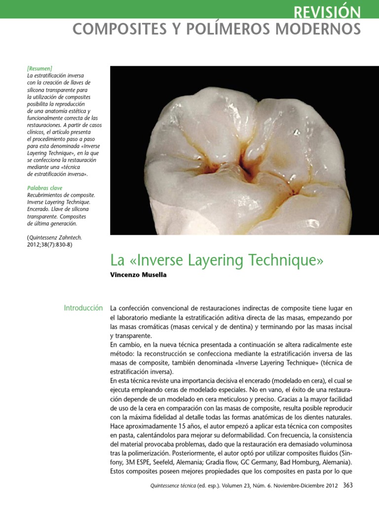 5 La Inverse Layering Technique | PDF | Compuesto Dental | Polímeros