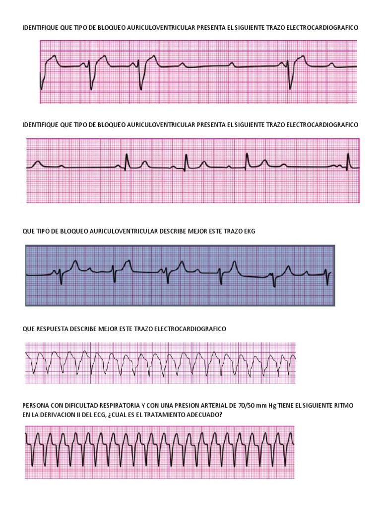 Guia de Estudio - Acls | PDF | Reanimación cardiopulmonar ...
