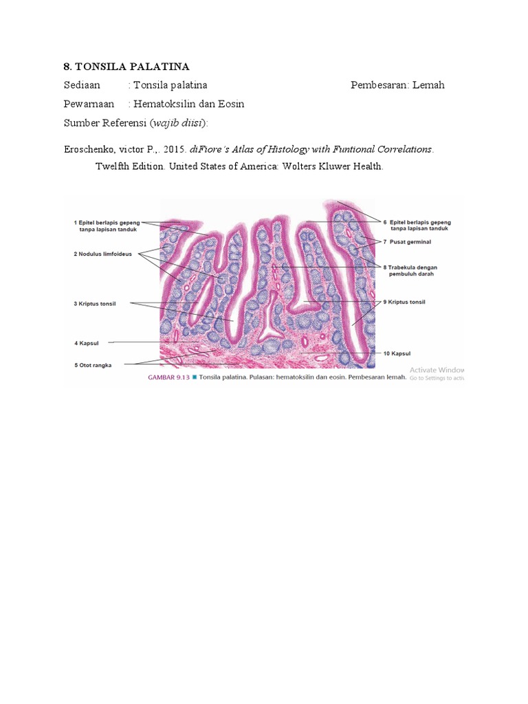 8 - Tonsila Palatina | PDF