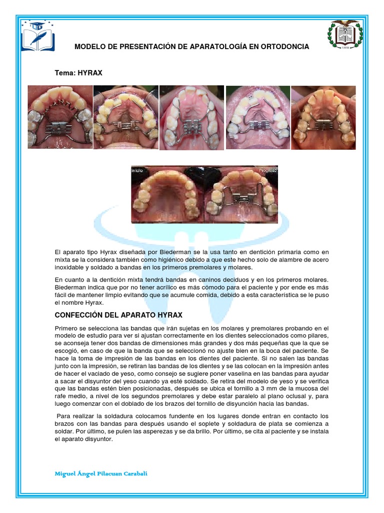 HYRAX | PDF | Diente | Tornillo