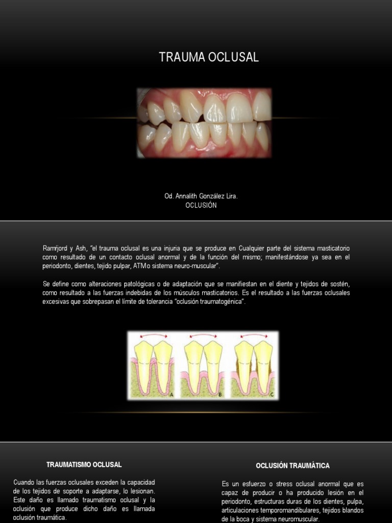 Trauma Oclusal | PDF | Odontología | Lesión