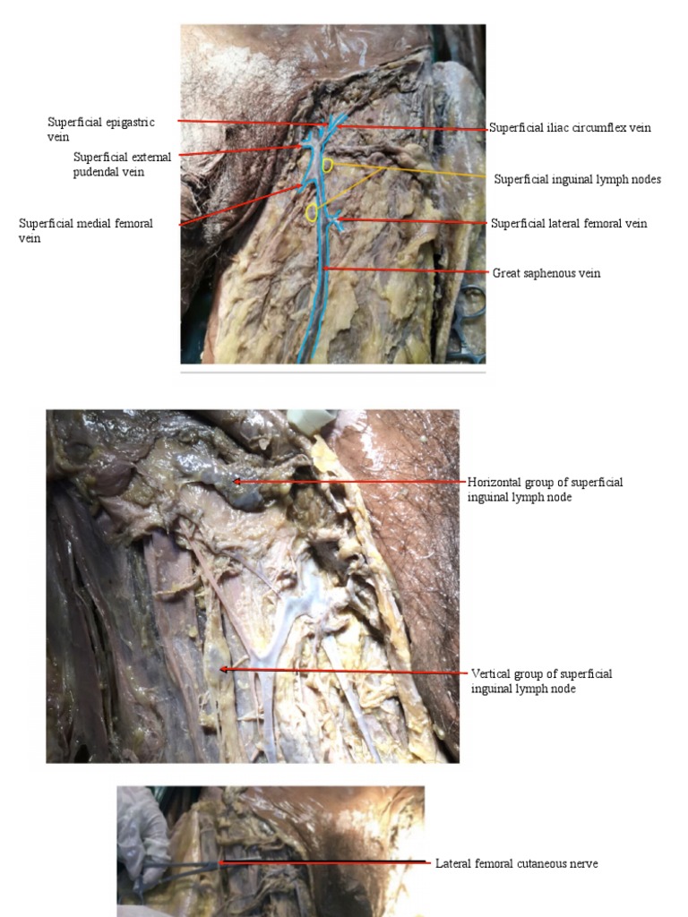 Group2-Anterior and Medial Aspects of The Thigh | PDF | Limbs (Anatomy ...
